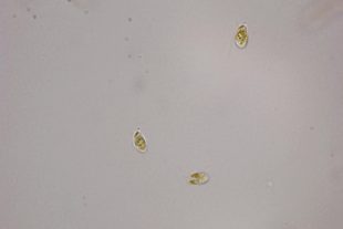 Using science to combat harmful algal blooms – Creating a better place